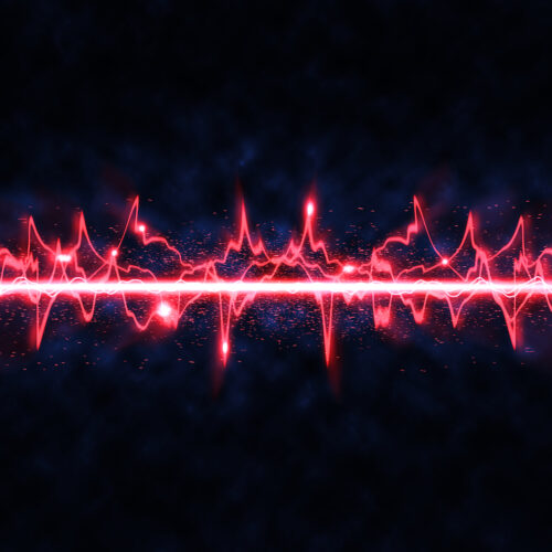 Featured Archives - LiquidSonics